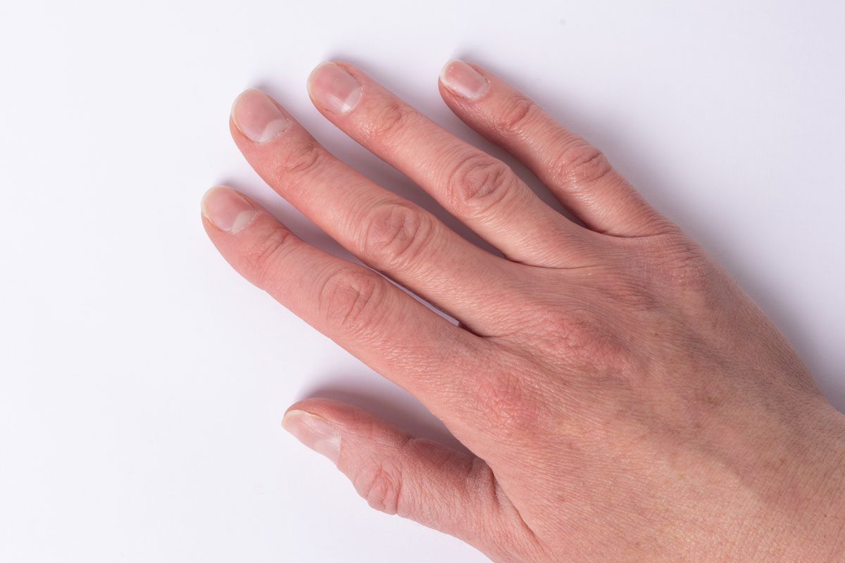 Rheumatologist Care in Singapore Aaria Rheumatology